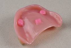 “პროთეზის წებო” — შესაძლო საფრთხე ჯანმრთელობისათვის – ყველაფერი ...